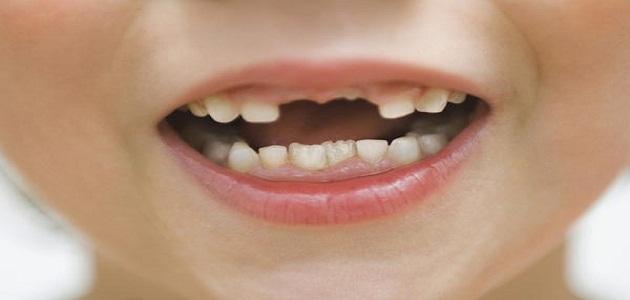 The most important interpretations of the dream of the front teeth ...